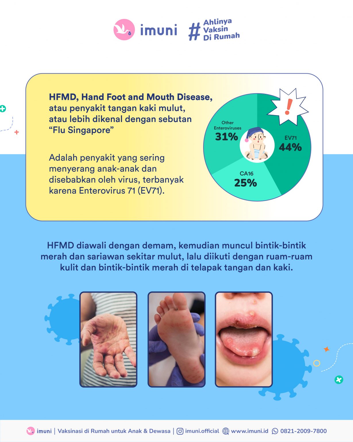 HFMD Flu Singapore SUDAH ADA VAKSINNYA! - INLIVE - imuni