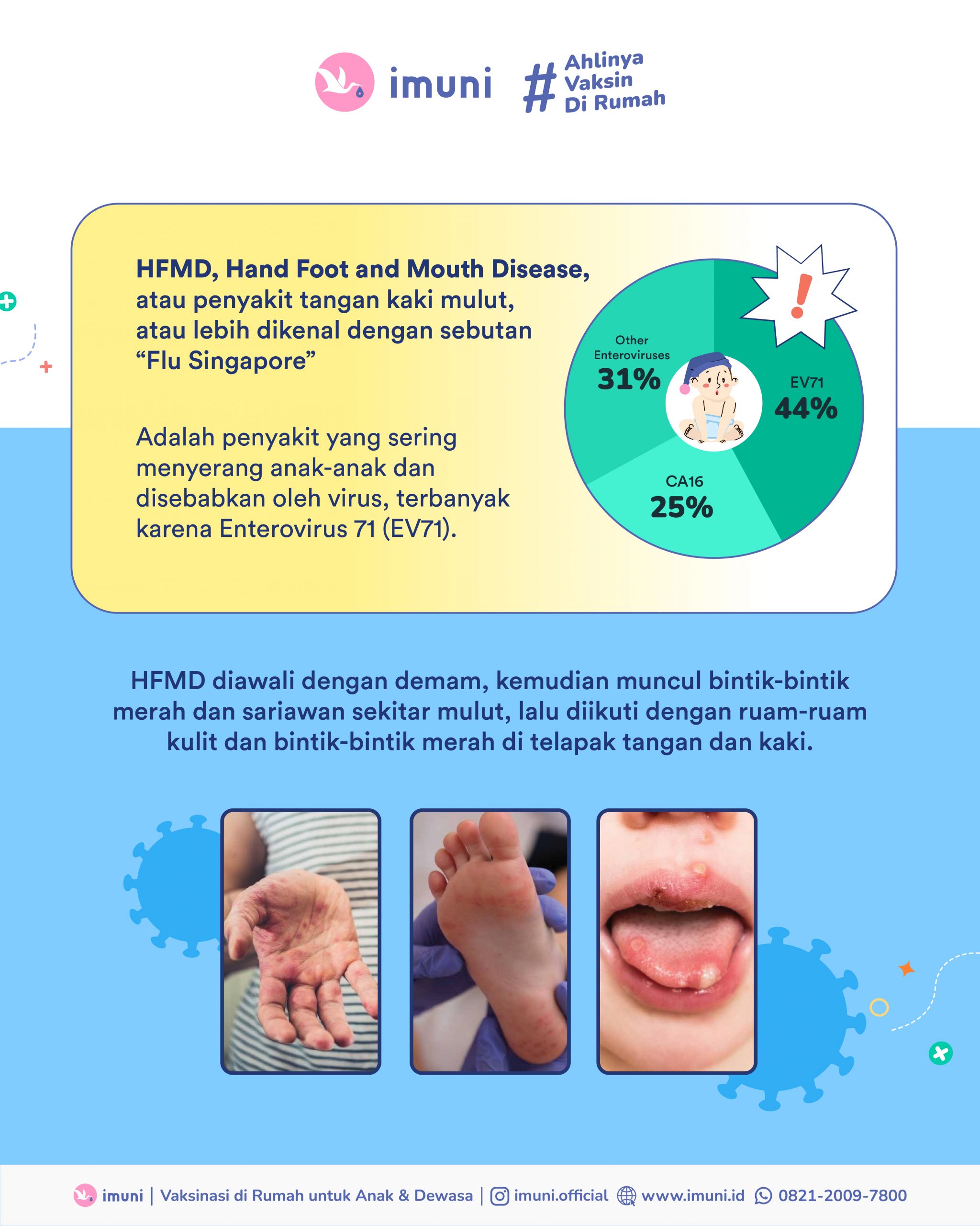 HFMD Flu Singapore SUDAH ADA VAKSINNYA! - INLIVE - imuni