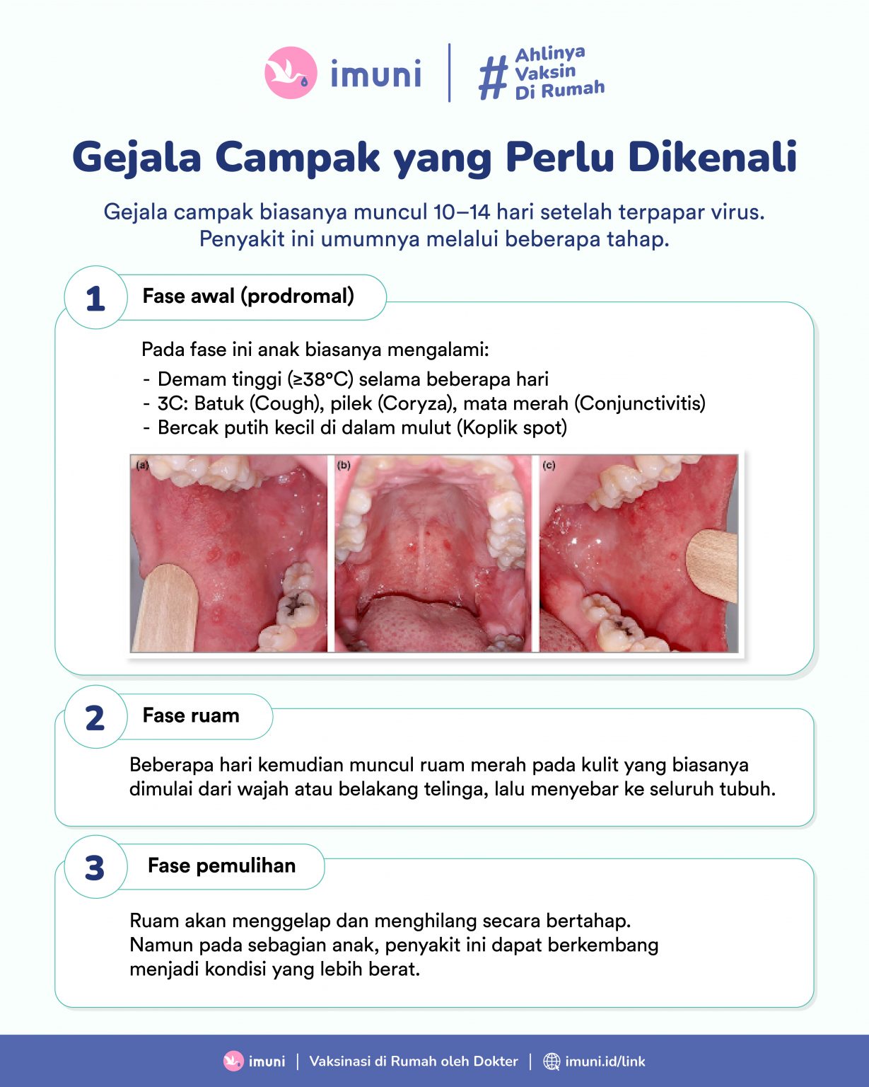 DARURAT! Update Kasus Campak di Indonesia - imuni